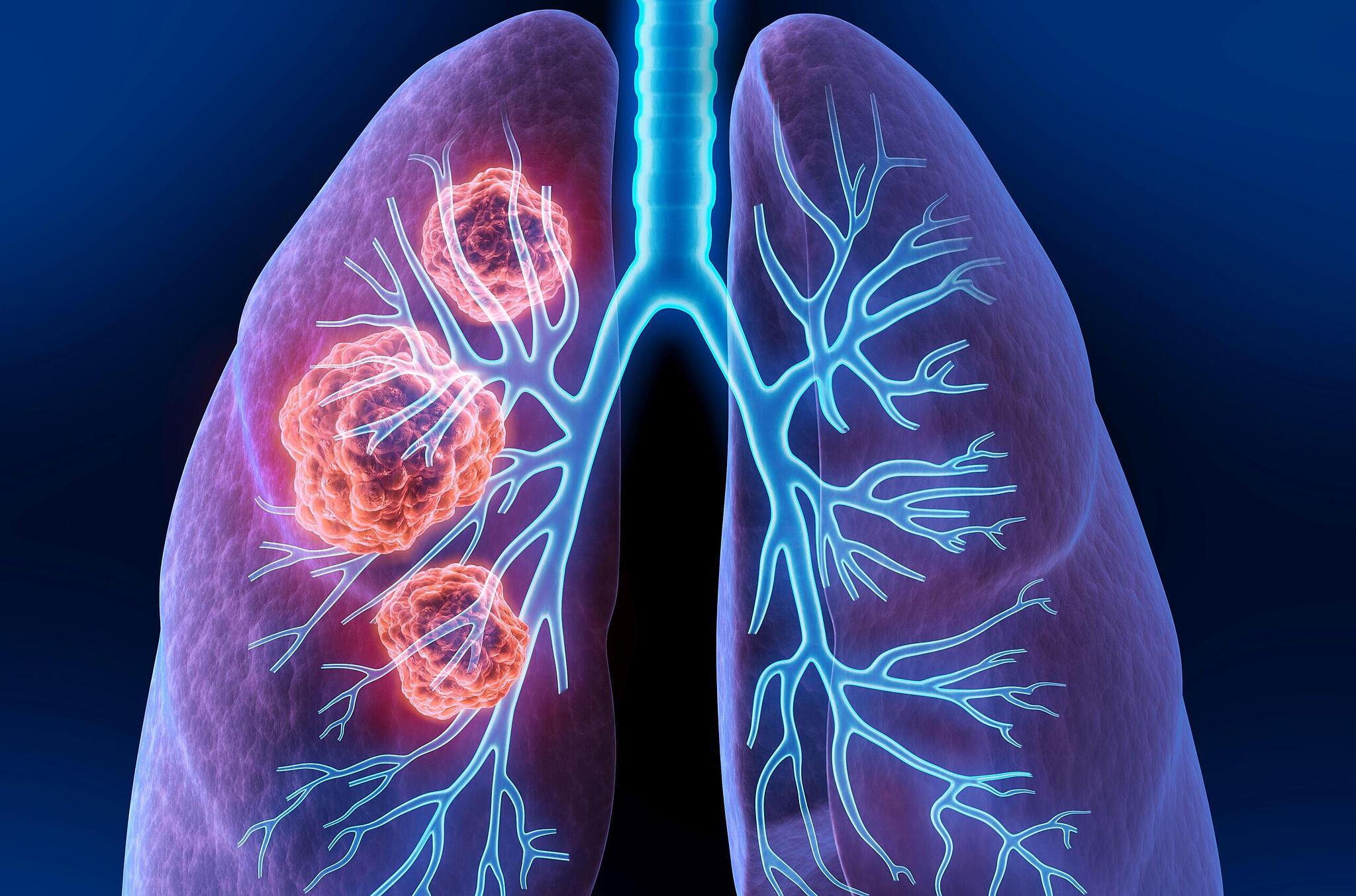 Klinikum Kulmbach stellt neue Behandlungsmethoden bei der Behandlung ...